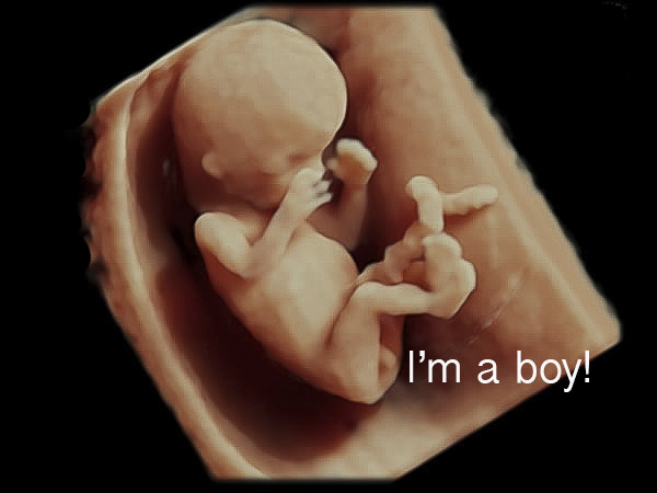 15 Week Ultrasound 3d